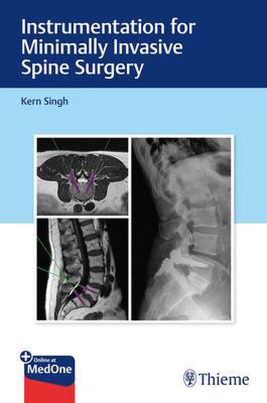 Instrumentation for Minimally Invasive Spine Surgery | 9781626232020 ...