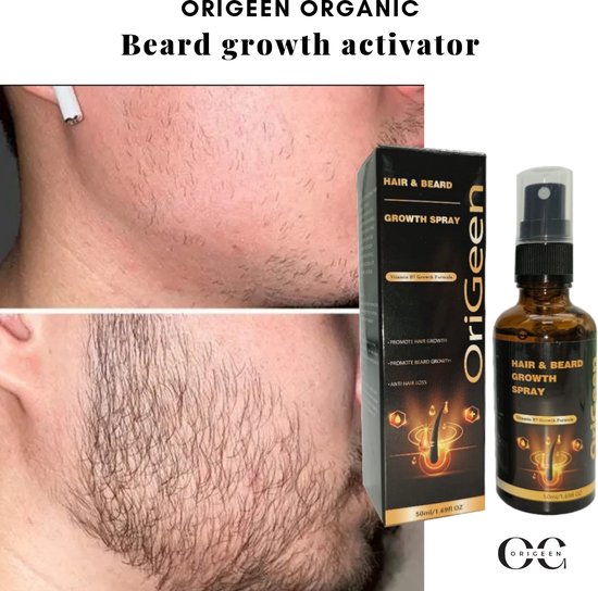 Origeen Baardgroei Serum Spray – Stimuleert Snelle & Dikke Baardgroei ...