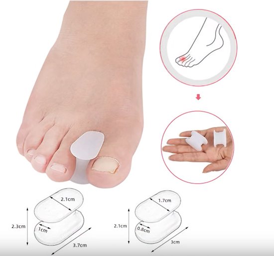 Tenenspreider 4 STUKS - Hallux Valgus - Silicone | bol