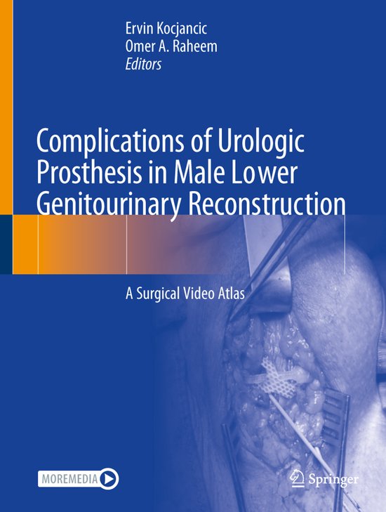Complications of Urologic Prosthesis in Male Lower Genitourinary ...