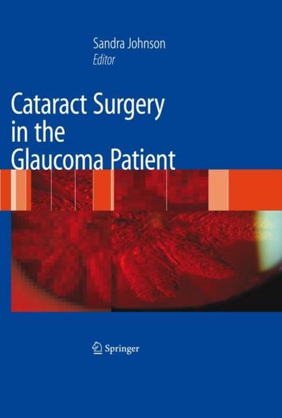 Cataract Surgery in the Glaucoma Patient | 9780387094076 | Sandra M ...