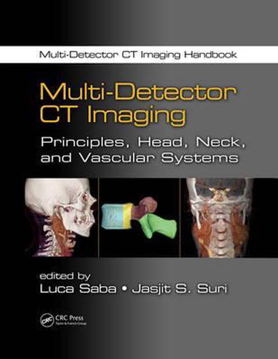 Multi-Detector Ct Imaging | 9781439893807 | Luca Saba | Boeken | bol.com