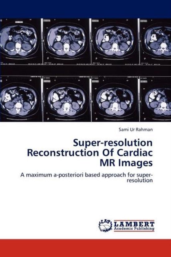 Super-resolution Reconstruction Of Cardiac MR Images | 9783846538159 ...