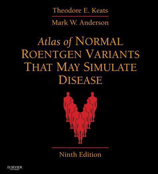 Atlas of Normal Roentgen Variants That May Simulate Disease - medical ...