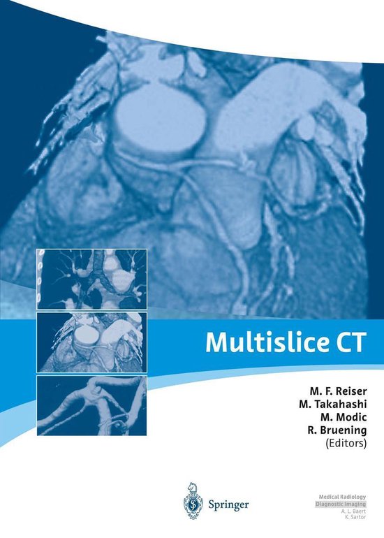 Medical Radiology - Multislice CT (ebook) | 9783642594410 | Boeken ...