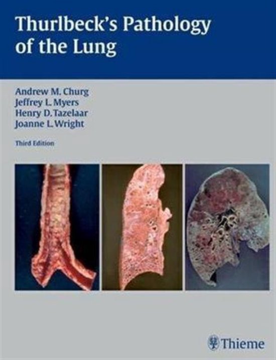 Thurlbeck's Pathology of the Lung | 9783136654033 | Boeken | bol