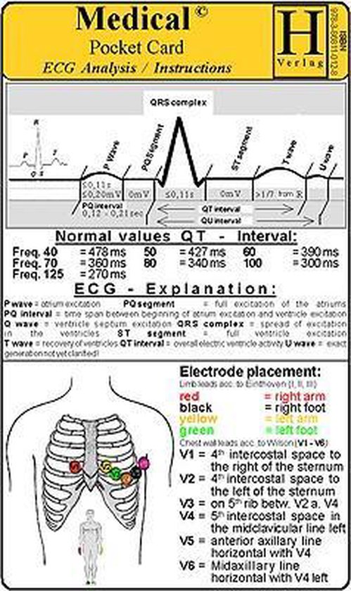 ECG Analysis/instruction - Medical Pocket Card, Verlag Hawelka ...