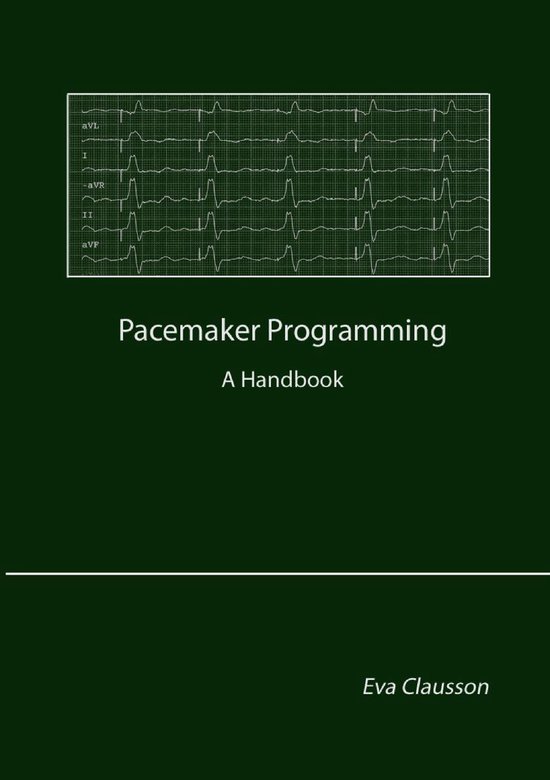 Pacemaker Programming (ebook), Eva Clausson | 9789175699240 | Boeken ...