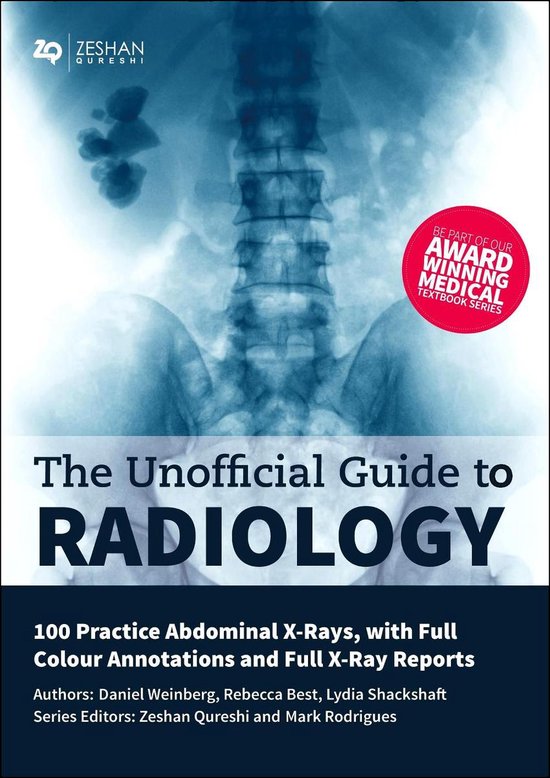Unofficial Guide to Radiology: 100 Practice Abdominal X Rays with Full ...
