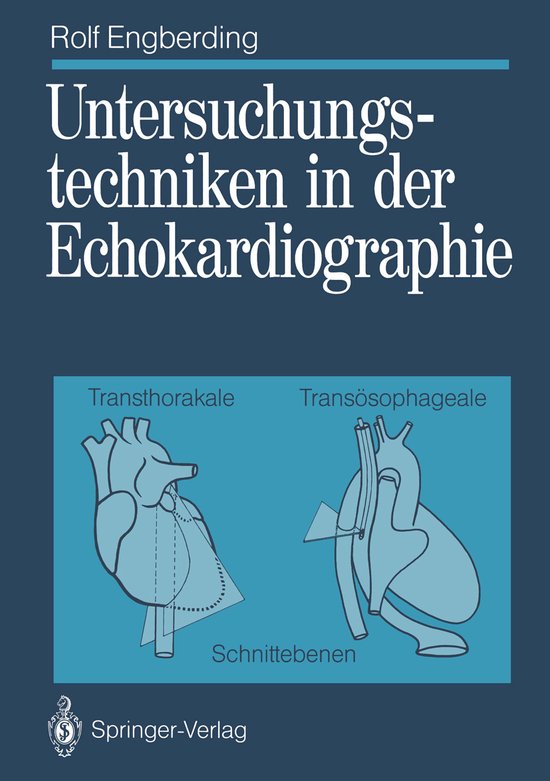 Untersuchungstechniken in Der Echokardiographie | 9783642741104 | Rolf Engberding | Boeken | bol