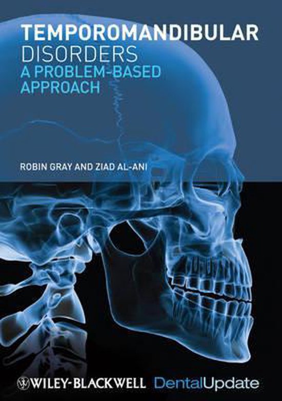 Temporomandibular Disorders 9781405199582 Robin Gray Boeken