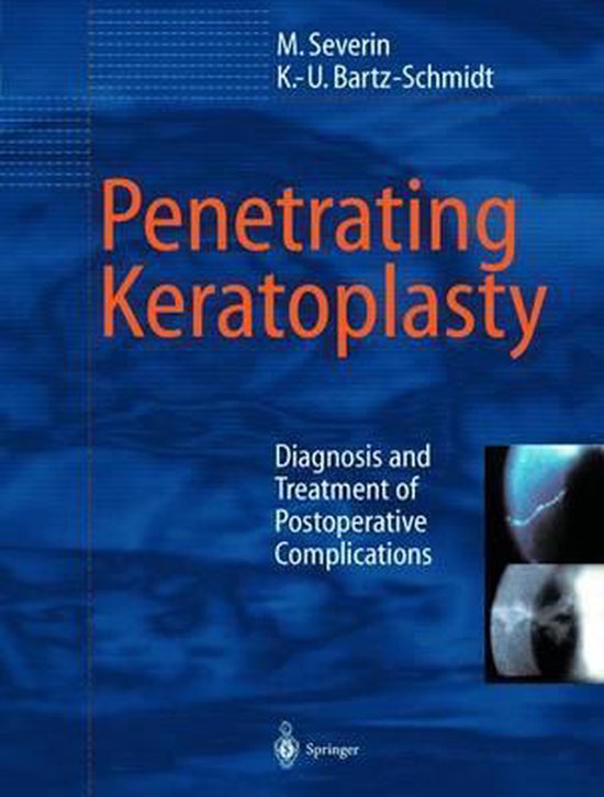 Penetrating Keratoplasty | 9783540664918 | Maria Severin | Boeken | bol