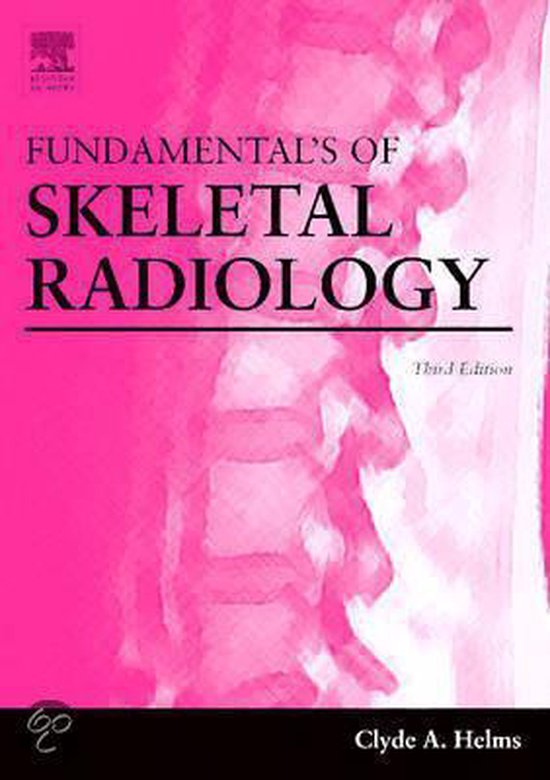Fundamentals of Skeletal Radiology, Clyde A. Helms | 9780721605708 ...