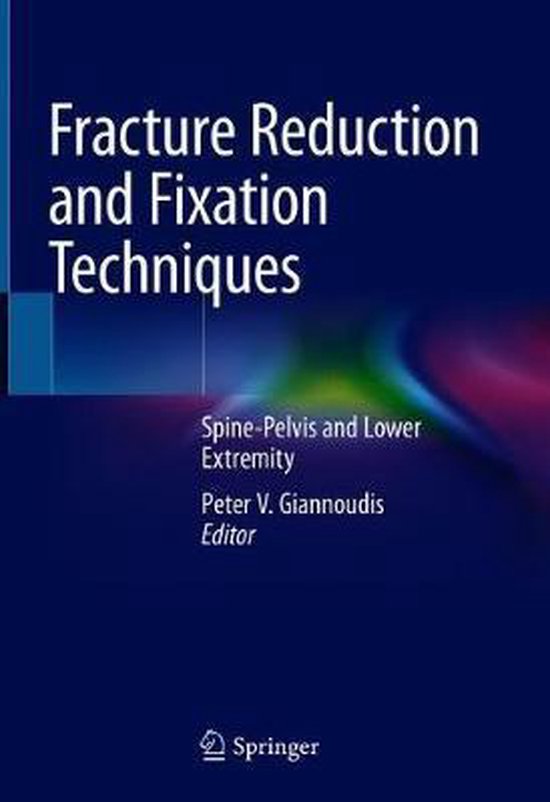 Fracture Reduction and Fixation Techniques | 9783030246075 | Boeken ...