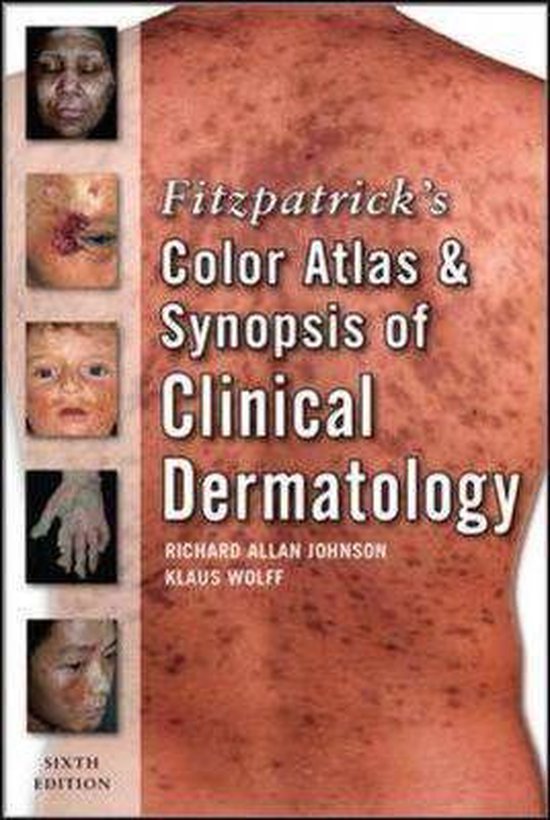 Fitzpatrick's Color Atlas And Synopsis Of Clinical Dermatology ...