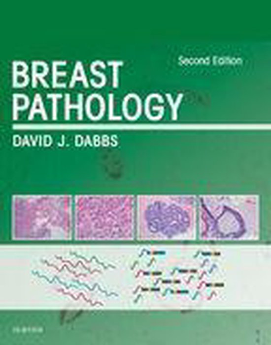 Breast Pathology E-Book (ebook), David J. Dabbs | 9780323462365 ...