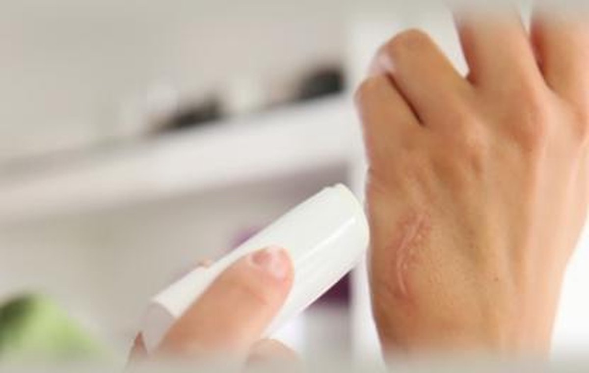 Remescar Silicone Litteken behandeling stick - Makkelijk aan te brengen ...