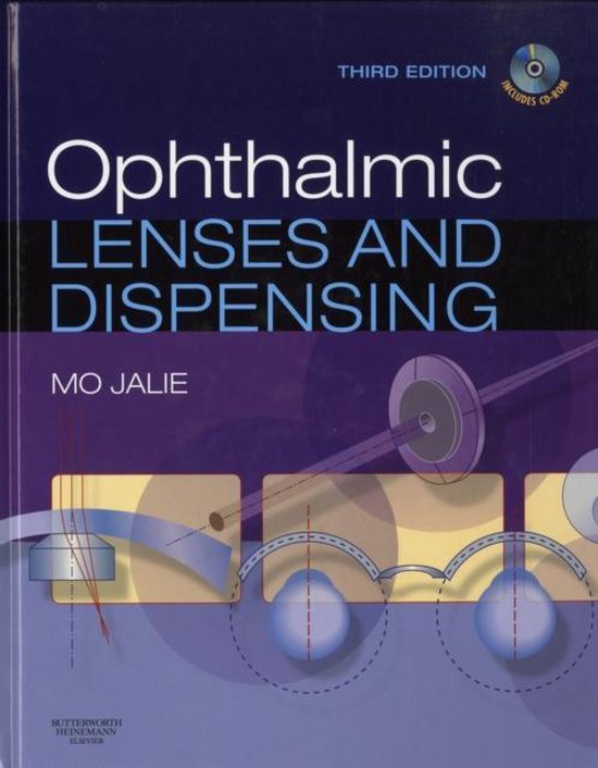 Ophthalmic Lenses & Dispensing | 9780750688949 | Mo Jalie | Boeken | bol