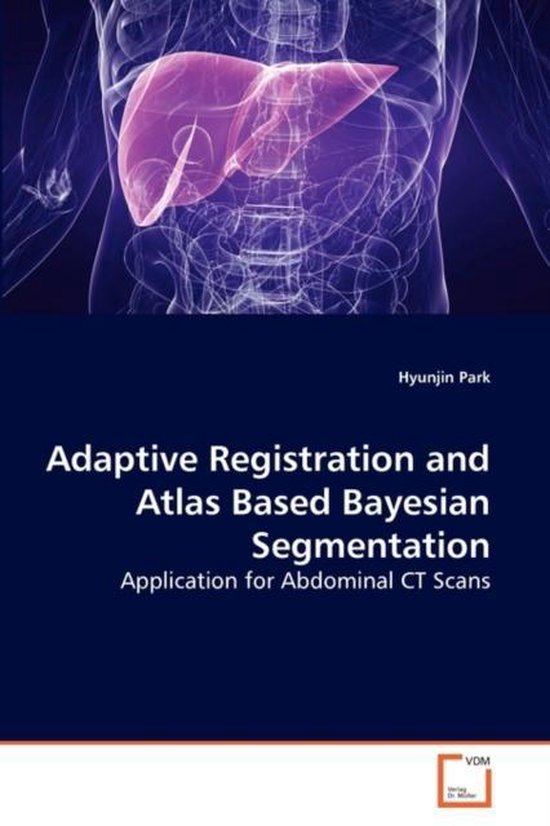 Adaptive Registration and Atlas Based Bayesian Segmentation ...