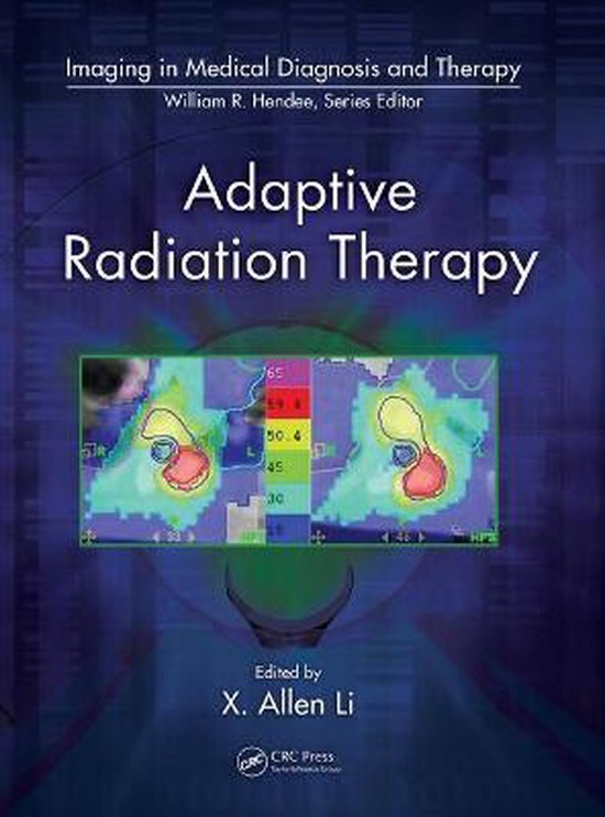 Adaptive Radiation Therapy | 9781439816349 | X. Allen Li | Boeken | bol.com