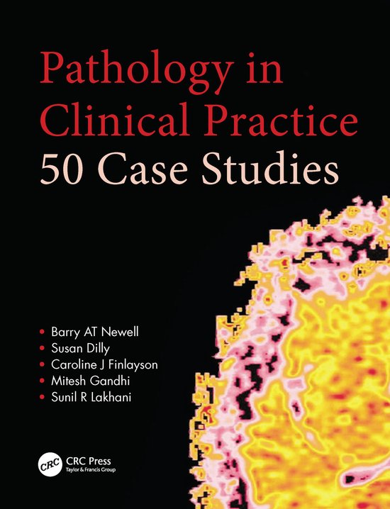 Pathology In Clinical Practice | 9780340959046 | Susan Dilly | Boeken | bol