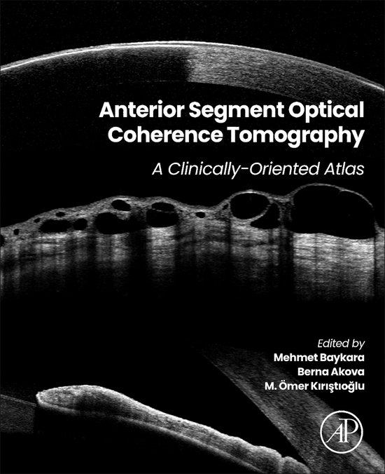 Anterior Segment Optical Coherence Tomography | 9780443221057 | Boeken ...