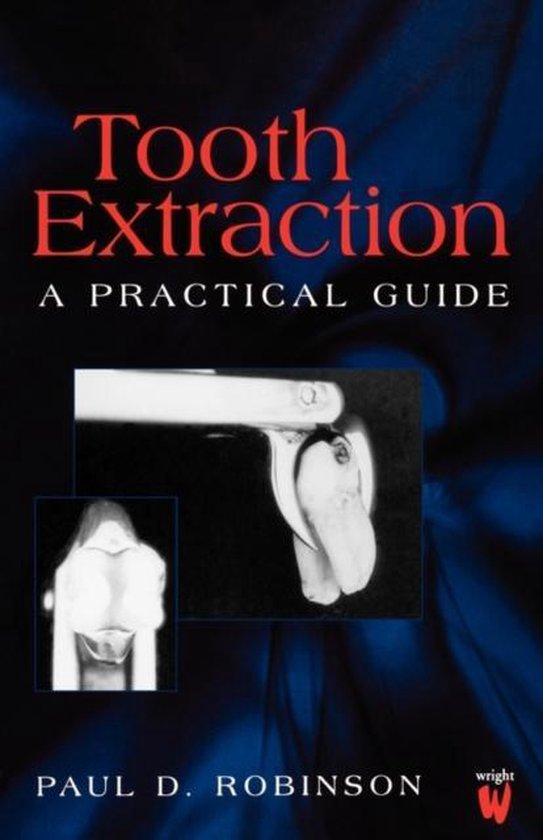 Tooth Extraction | 9780723610717 | Geoffrey L. Howe | Boeken | bol