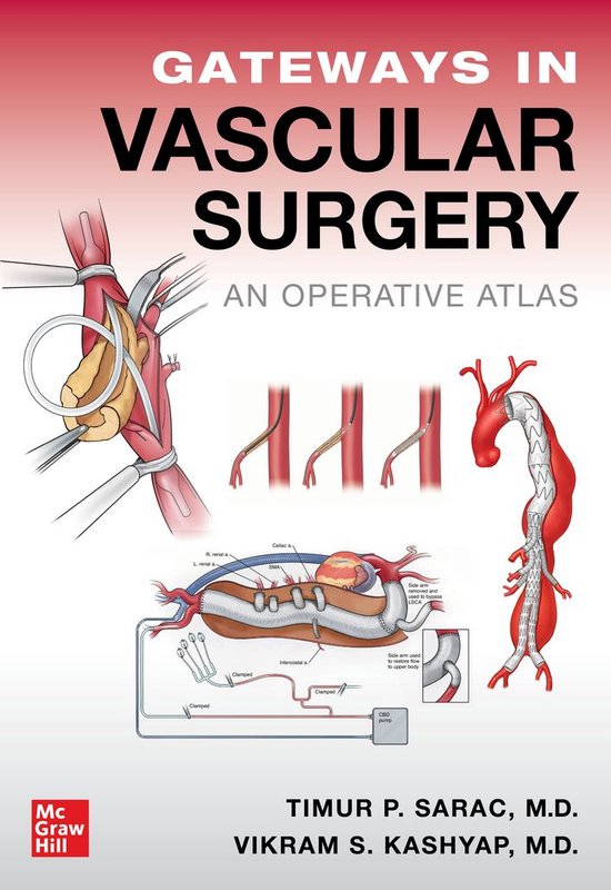 Gateways in Vascular Surgery: An Operative Atlas (ebook), Timur Sarac ...