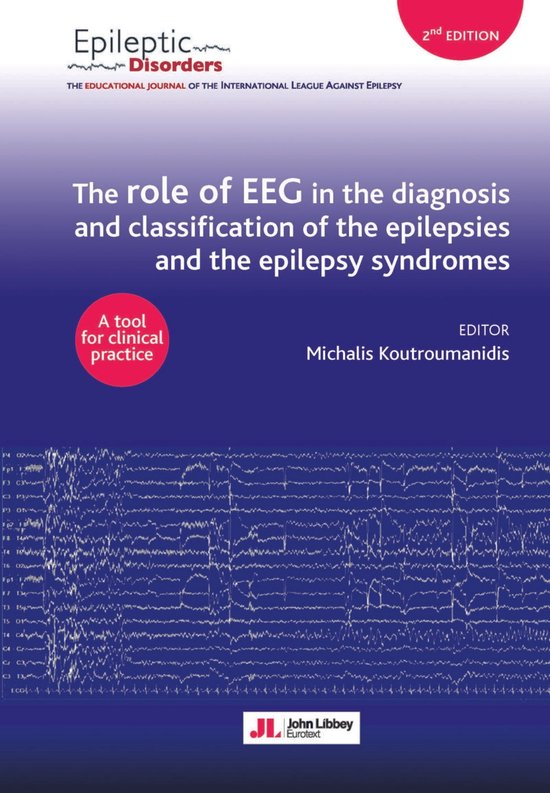 Epileptic disorders - The role of EEG in the diagnosis and ...