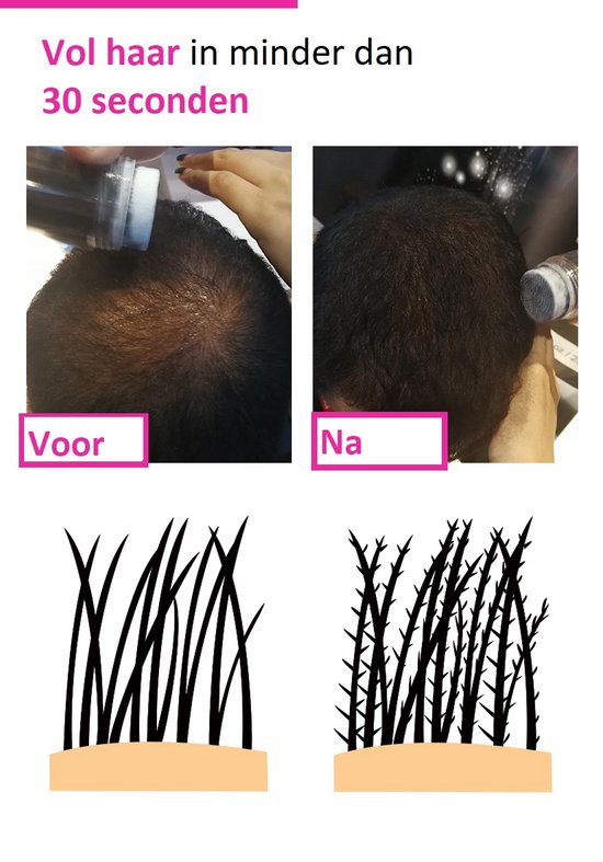 Sevich Haarpoeder - Haarvezels - Volume Poeder - Haarlijn - Keratine ...