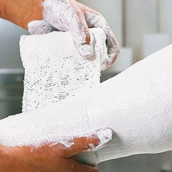 Vaessen Creative Gipsverband - 8cm x 2m | bol