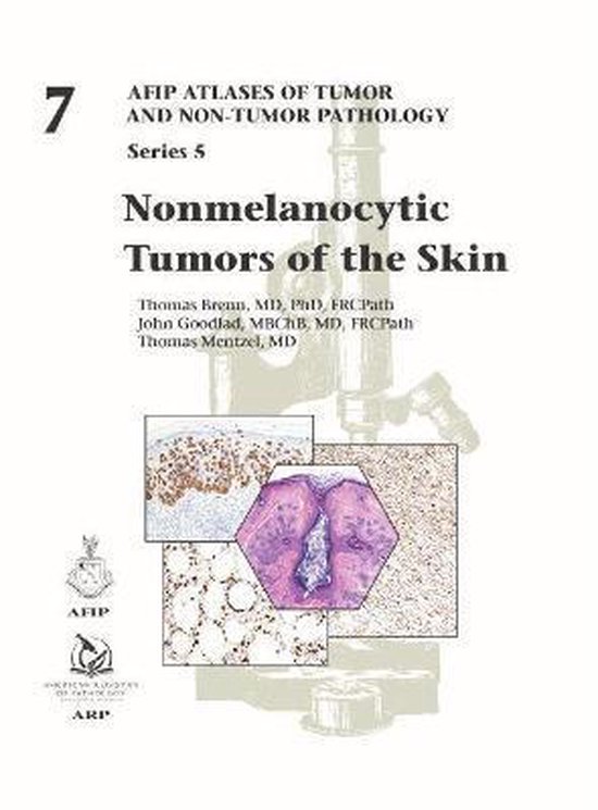 AFIP Atlas of Tumor and Non-Tumor Pathology, Series 5- Nonmelanocytic Tumors of the... | bol